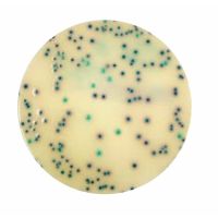 Brilliance ESBL-Agar | Nährböden | Mikrobiologie | Labor & Diagnostik ...